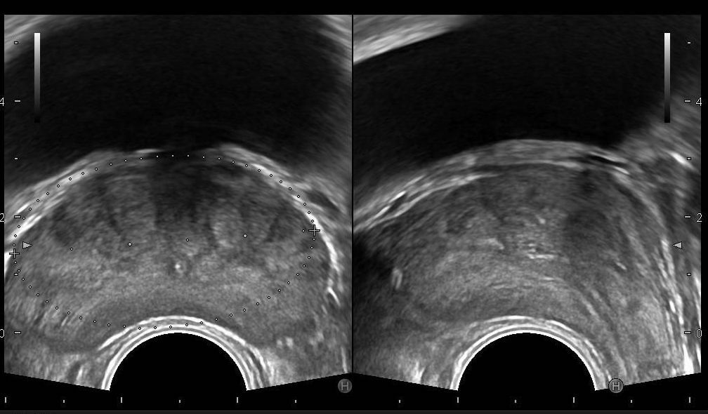 Examens échographiques | Urologues Saint Augustin